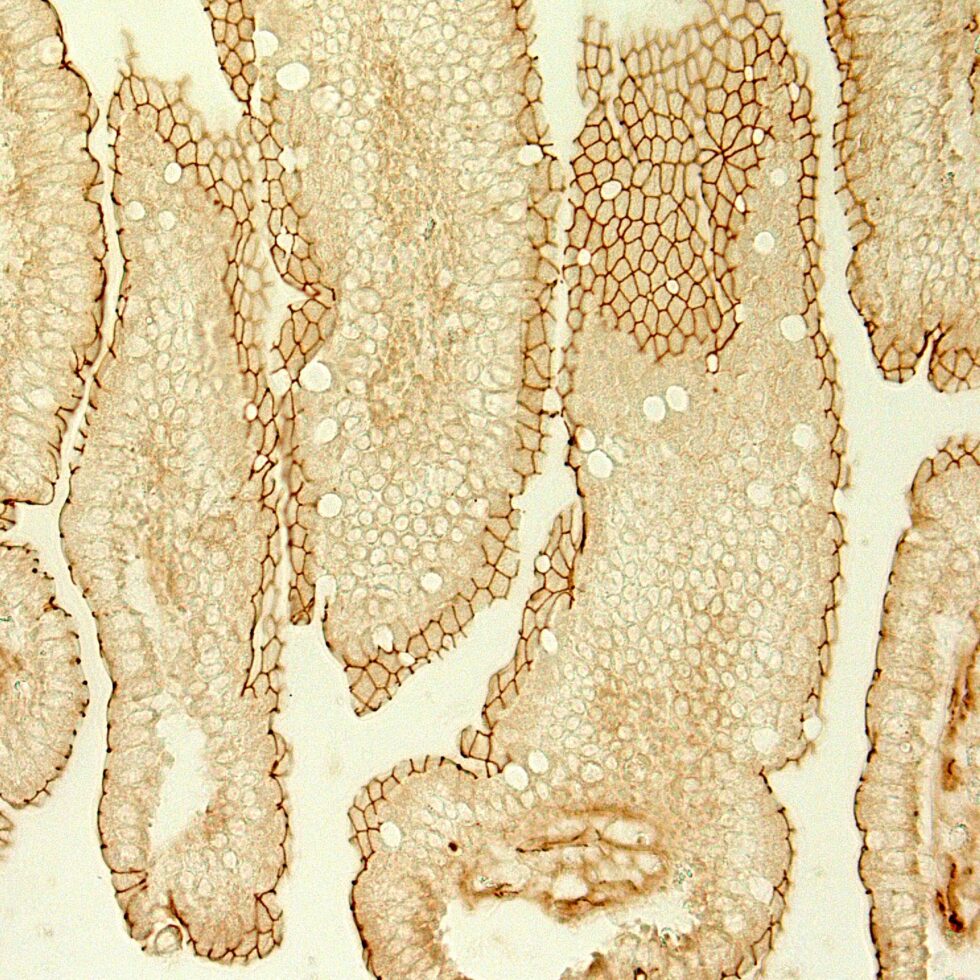 Immunomarquages | PICMO